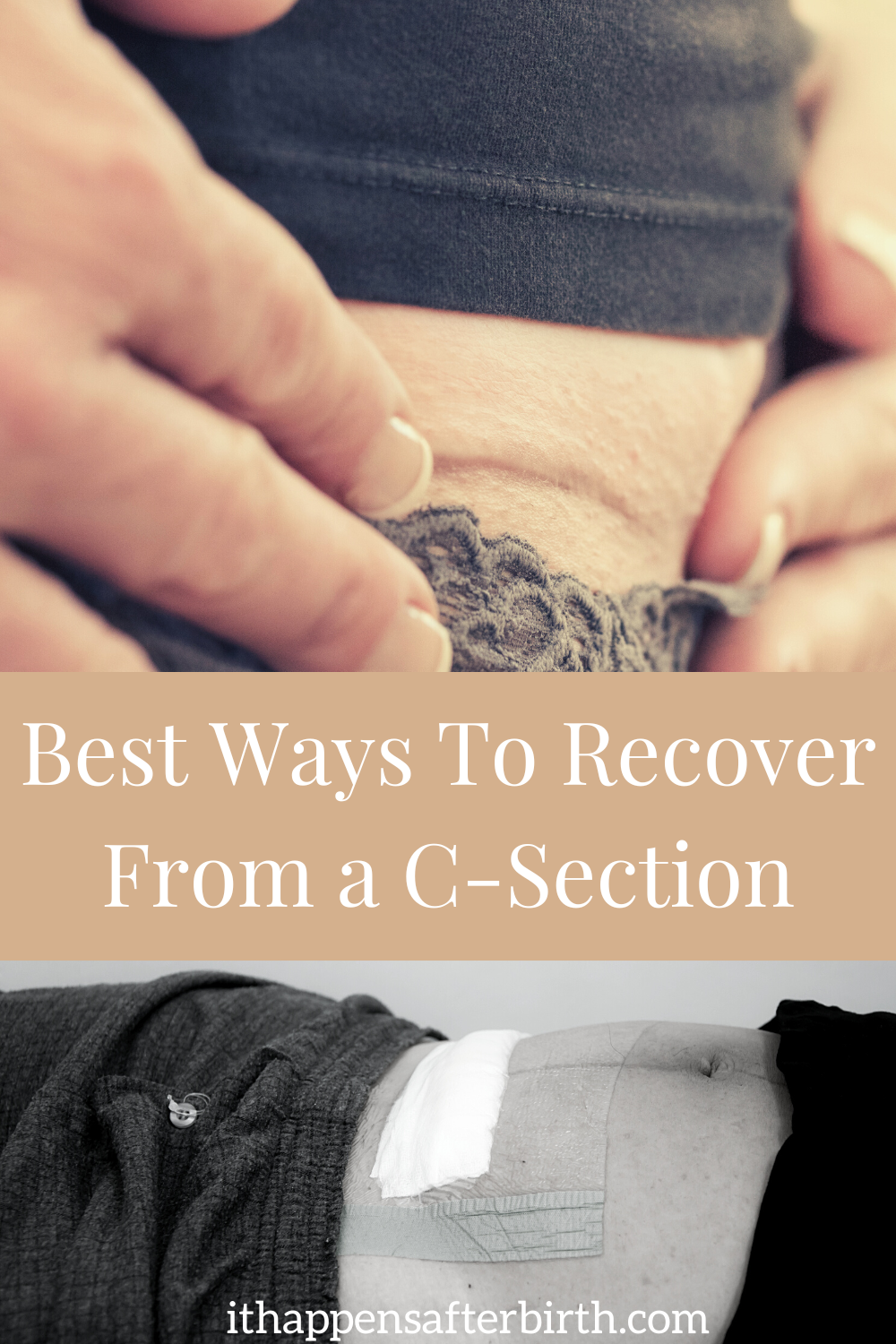 Best Ways to Recover from a C-Section - It Happens After Birth